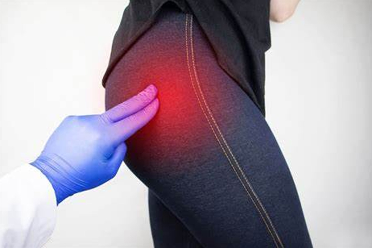 Trochanteric Bursitis And PT Treatment Symmetry Physical Therapy